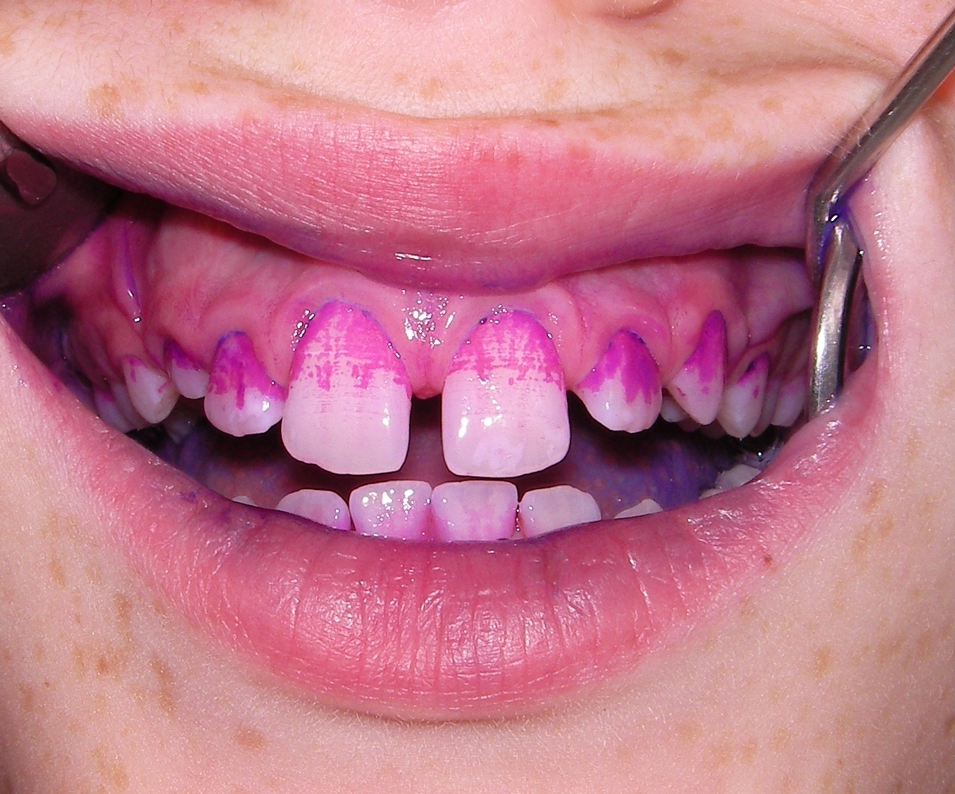 Prophylaxe – Dr. Michael Sereny